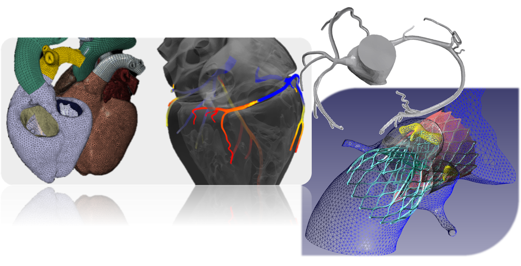 Cardiac simulations