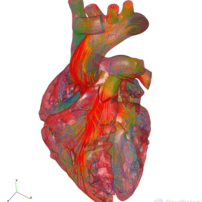 FlowVision and SIMULIA Benelux RUM